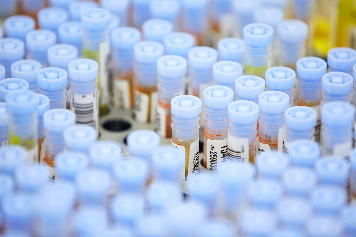 Neues Labor ist ein Quantensprung für Klinische Chemie am UKR